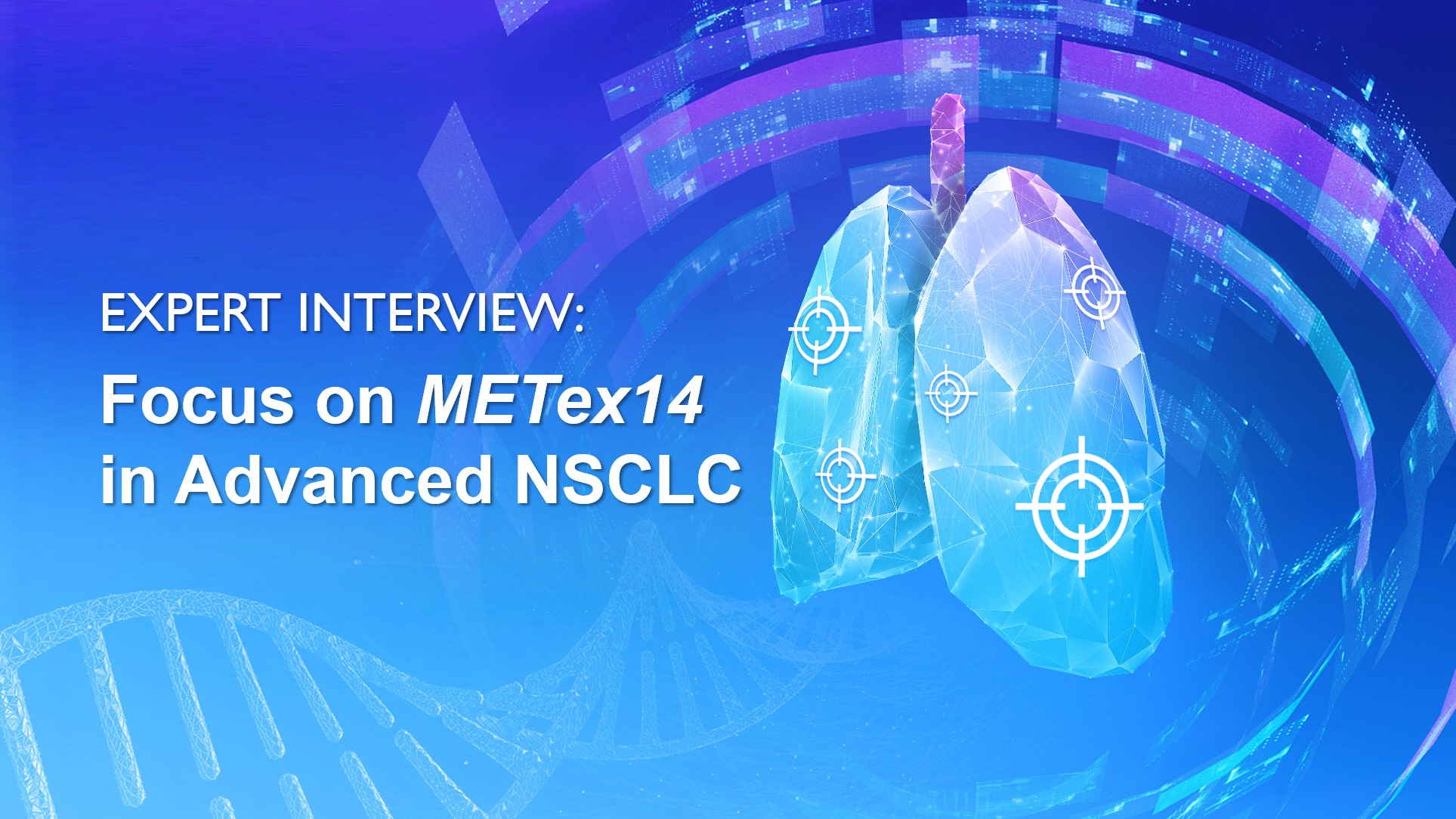 EXPERT INTERVIEW: Focus on METex14 in Advanced NSCLC - ACE Oncology